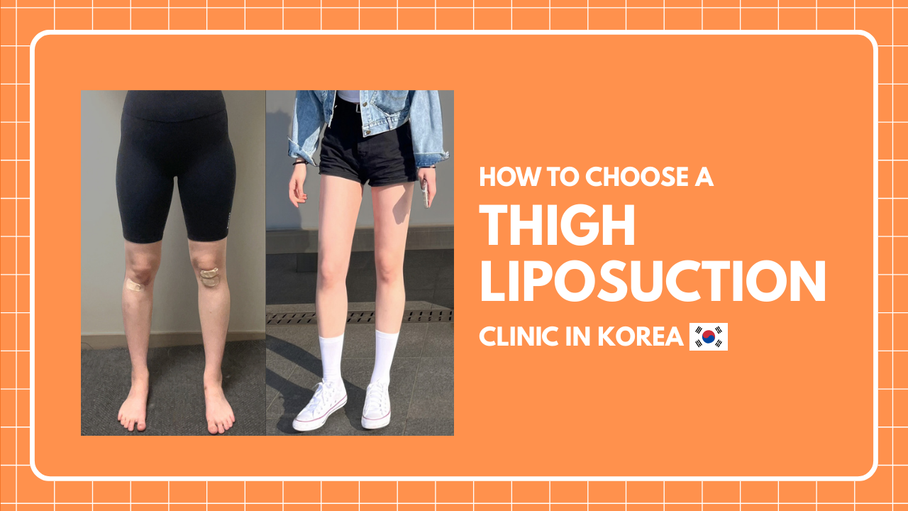 How to Choose a Thigh Liposuction Clinic in Korea | 365mc